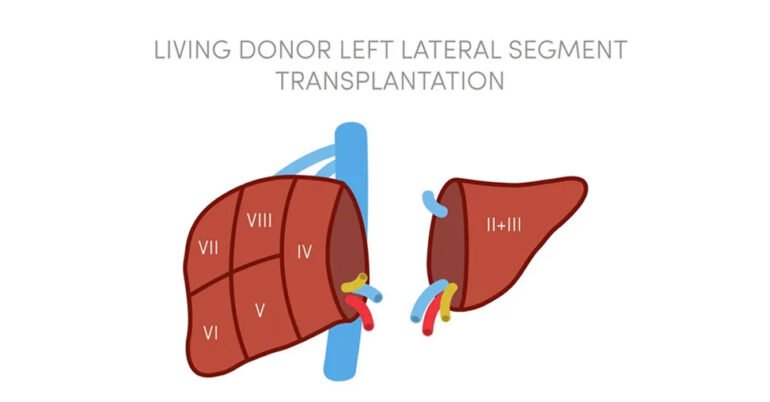 Liver Transplant - Dr Pathik Parikh